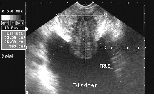 Common Symptoms and Investigations of Urinary system - medlight2u.com